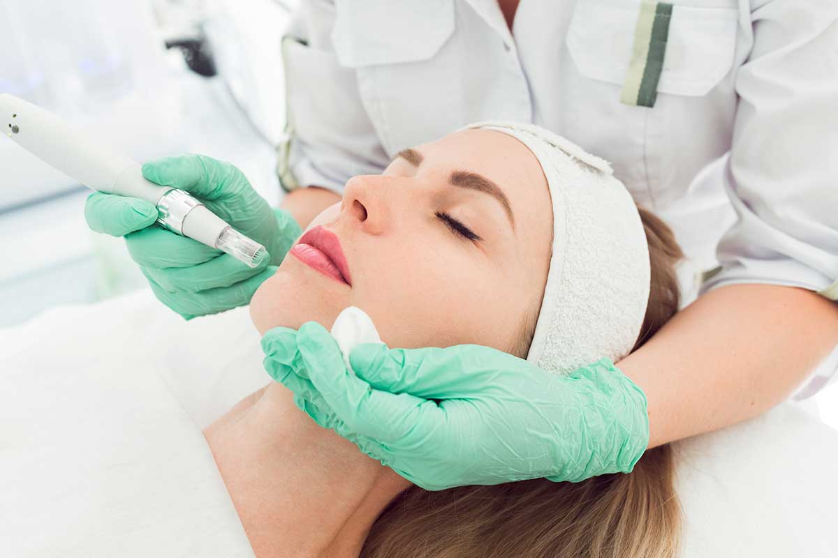 Microneedling ("Vampire Facial") - Dr. Rabi Dermatology