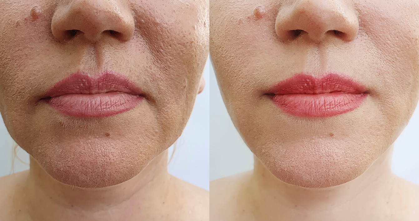 Sina Rabi - Dr. Rabi Dermatology