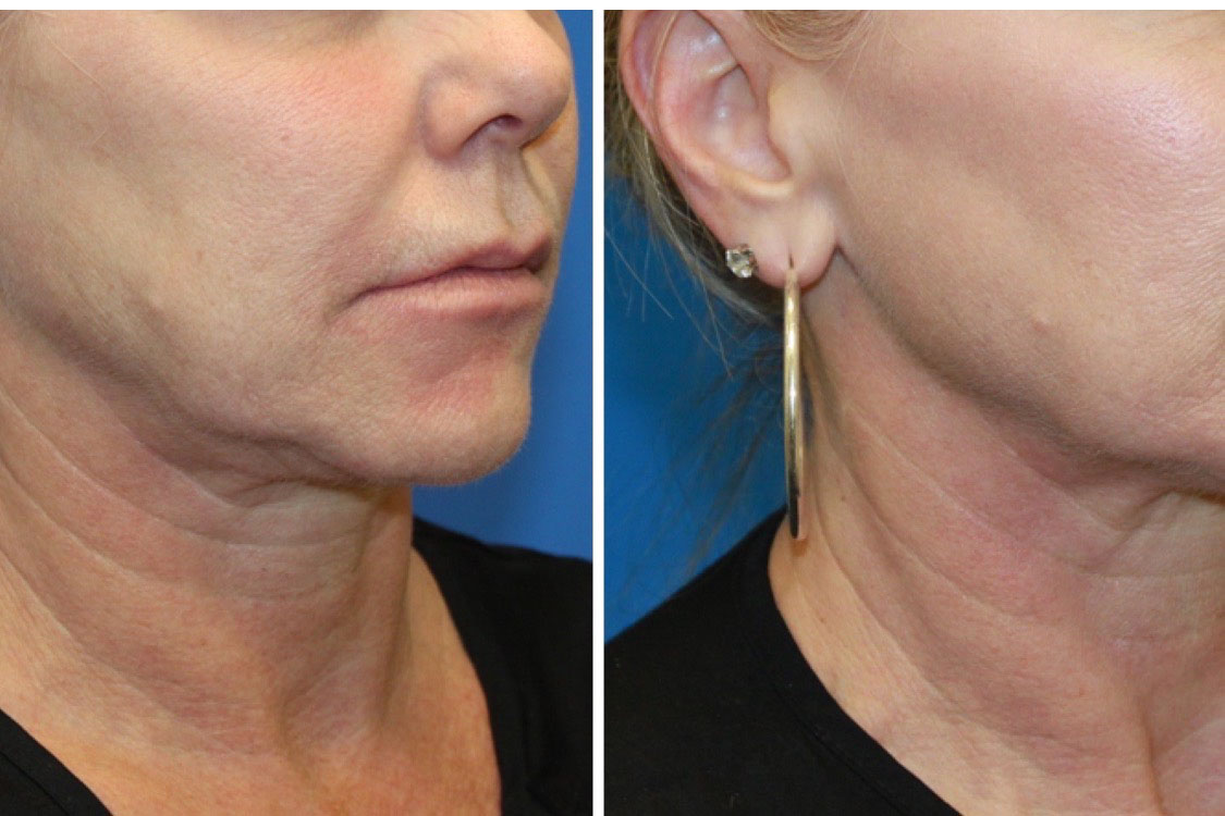 Gallery – Dr. Rabi Dermatology