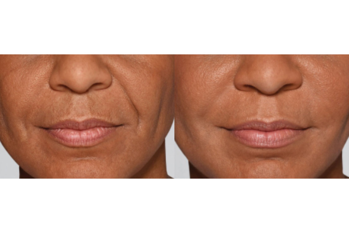 Gallery – Dr. Rabi Dermatology