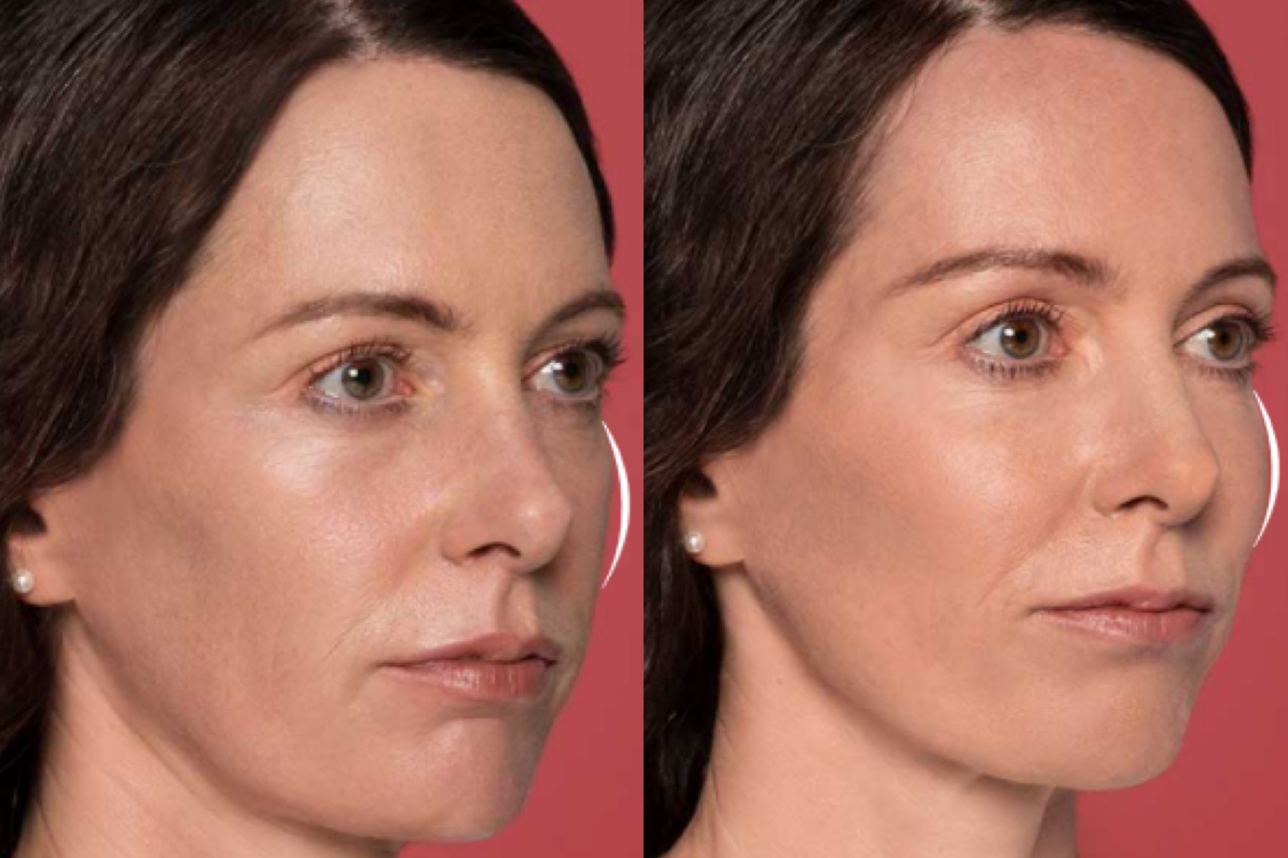 Gallery – Dr. Rabi Dermatology