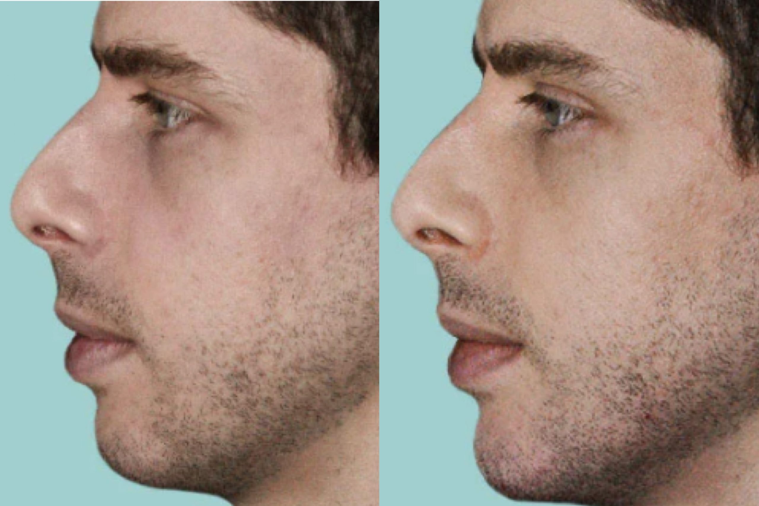 Gallery – Dr. Rabi Dermatology