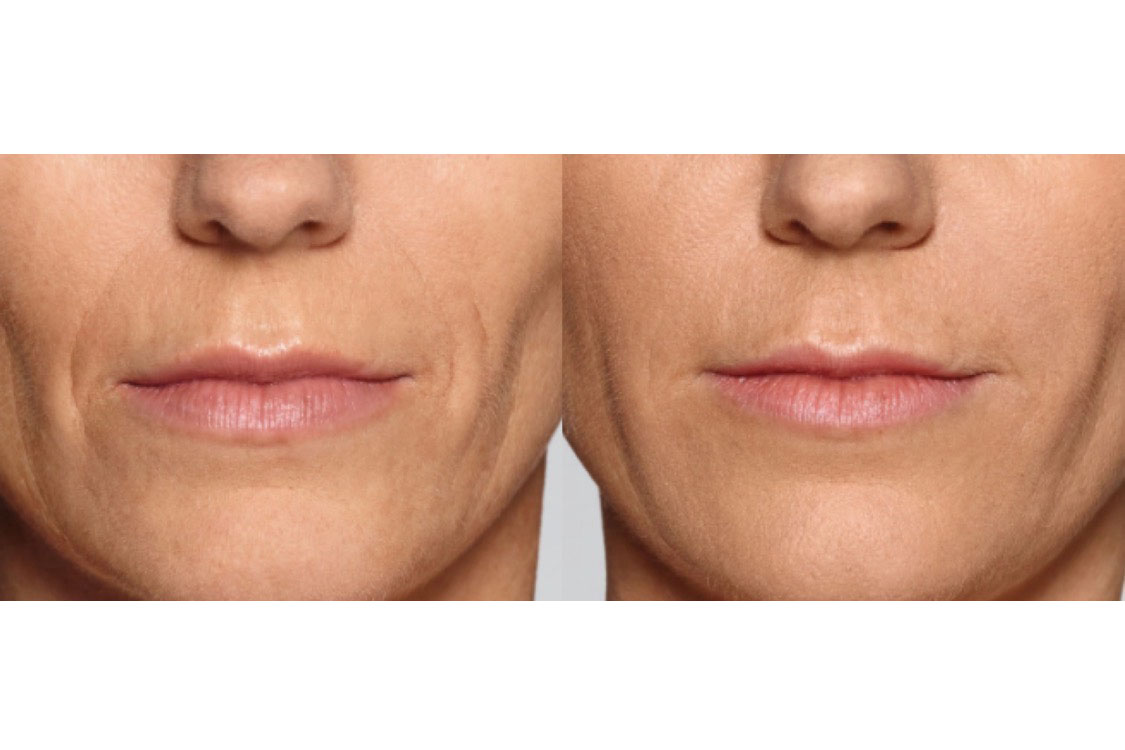 Gallery – Dr. Rabi Dermatology