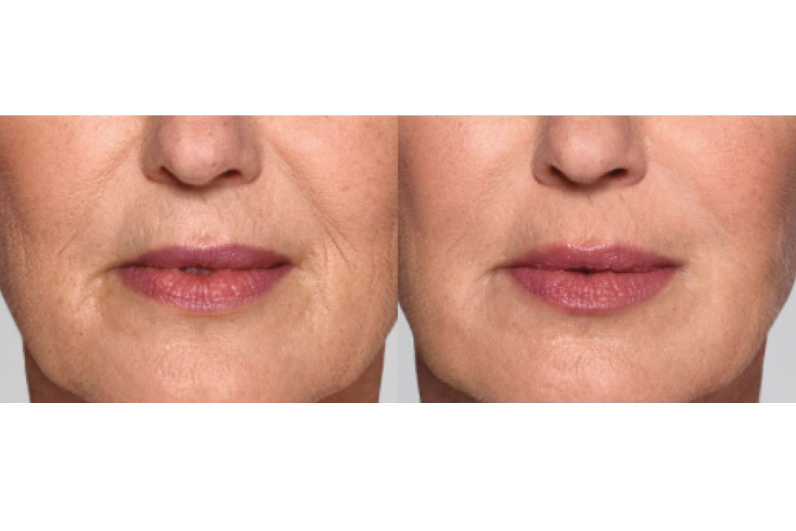 Gallery – Dr. Rabi Dermatology